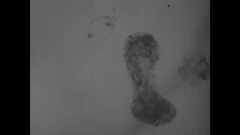 1940s: Amoeba. Different types of cells... | Stock Video | Pond5