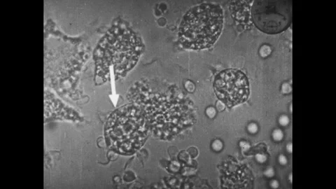 1940s: Microphotography of a white blood... | Stock Video | Pond5