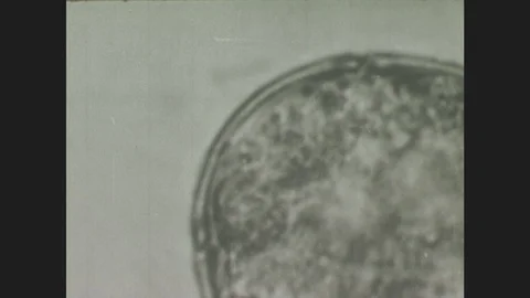 1940s: Morphology of tapeworm egg under ... | Stock Video | Pond5