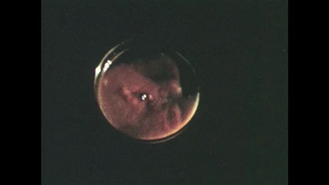 1940s: Sea turtle embryo in different st... | Stock Video | Pond5