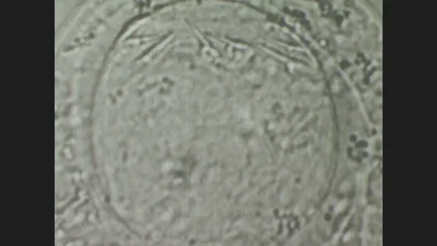 Coracidium Stock Video Footage | Royalty Free Coracidium Videos | Pond5