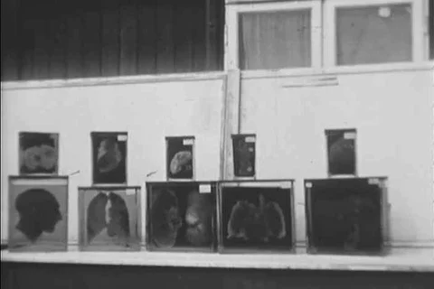 1945 - Dachau medical experiments are se... | Stock Video | Pond5