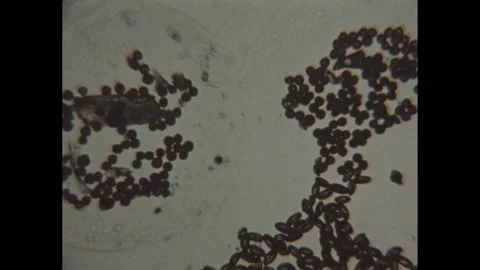 1950s: Film card. Bacteria under microsc... | Stock Video | Pond5