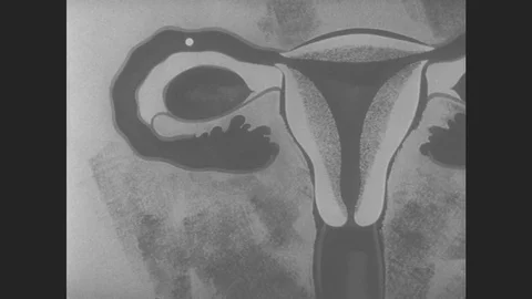 1950s: Illustration of female reproducti... | Stock Video | Pond5