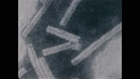 1950s: Microscopic view of long cells. T... | Stock Video | Pond5