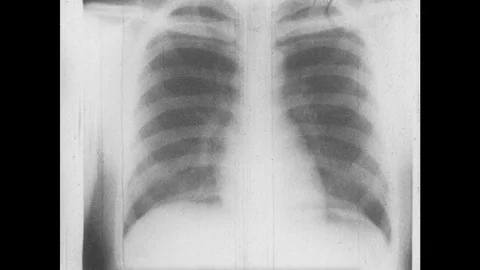 1950s: X-ray of torso, heart beating. Ma... | Stock Video | Pond5