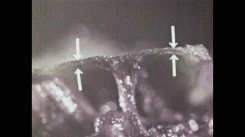 1960s: Cross section of a liverwort plan... | Stock Video | Pond5
