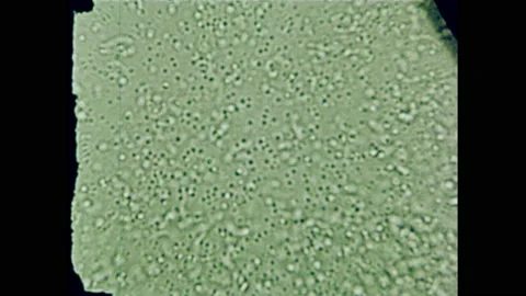 1960s: Magnified view of bacteria. Man s... | Stock Video | Pond5