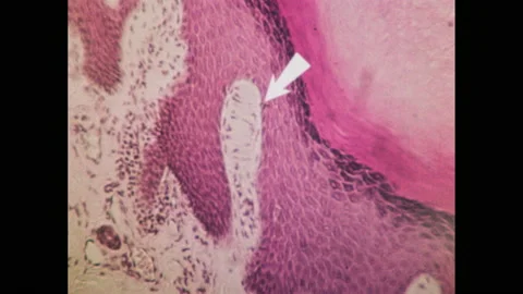 Microscopic Nerve Stock Video Footage | Royalty Free Microscopic Nerve ...