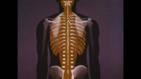1960s: Muscles appear over skeleton of i... | Stock Video | Pond5