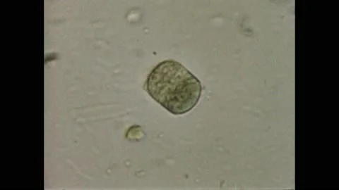 1970s: blue green algae under microscope... | Stock Video | Pond5