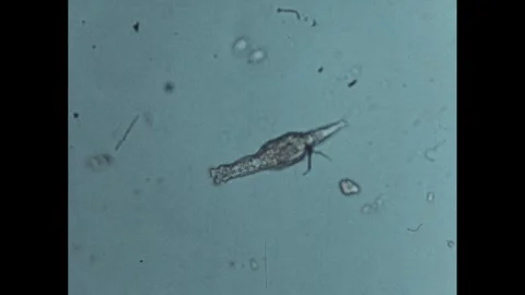 1970s: Hands put slide under microscope.... | Stock Video | Pond5