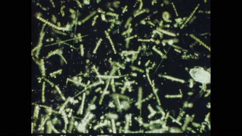 1970s: microscopic view of golden algae.... | Stock Video | Pond5