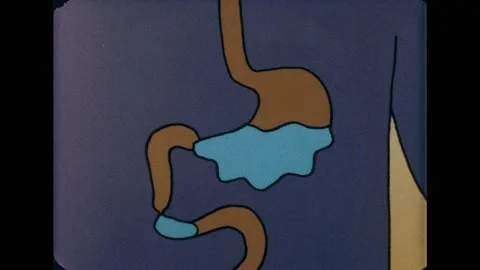 1990s: Animation - a churning stomach re... | Stock Video | Pond5