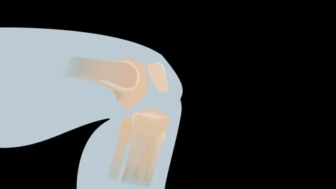 2d medical animation of knee pain, pulsa... | Stock Video | Pond5