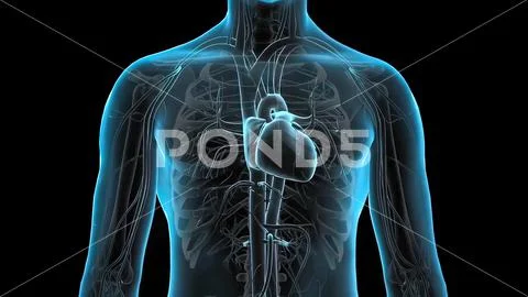 3D Animatied Stent angioplasty procedure: Royalty Free #221342318