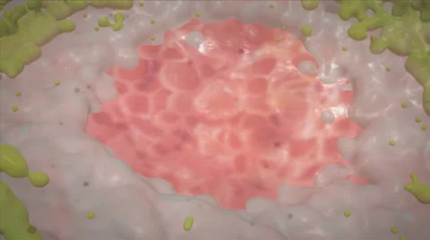 3D animation of the Gastric ulcer | Stock Video | Pond5