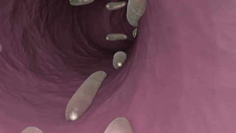 3D animation of parasitic worms in an in... | Stock Video | Pond5