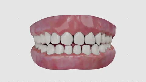 3D animation real tooth braces movement ... | Stock Video | Pond5