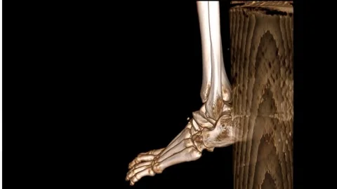 Ct Scan Isolated Stock Footage ~ Royalty Free Stock Videos | Pond5