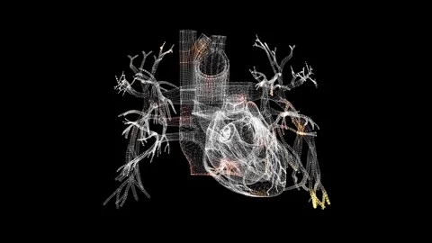 3D heart Scan. Heart Scanning Interface.... | Stock Video | Pond5