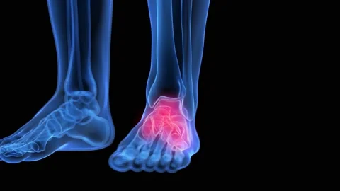 Ankle Bone Stock Footage ~ Royalty Free Stock Videos | Pond5