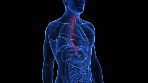 3d medical animation of the inflammation... | Stock Video | Pond5