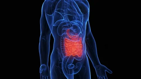 3d medical animation of the inflammation... | Stock Video | Pond5