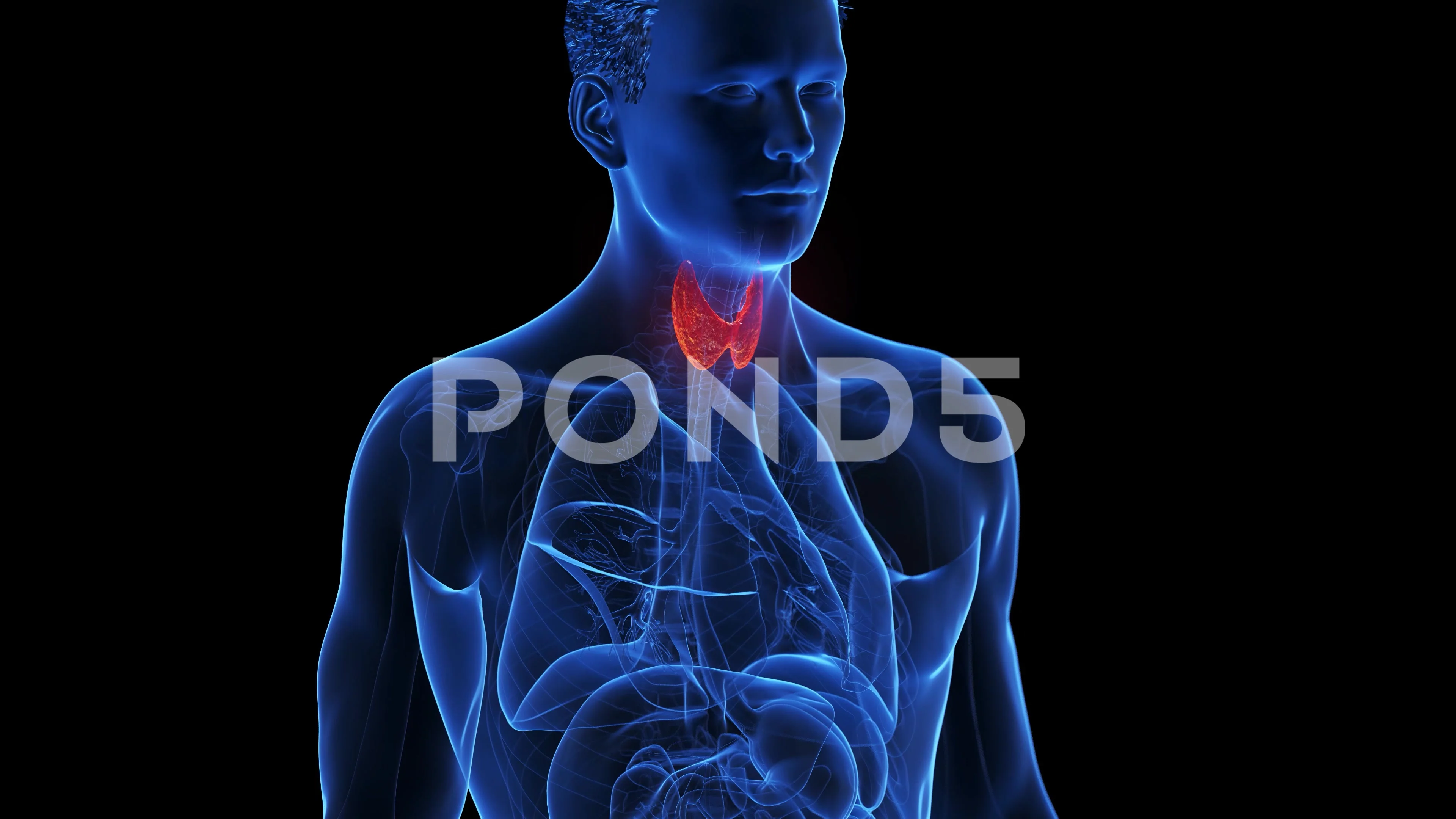 Inflamed Thyroid Animation