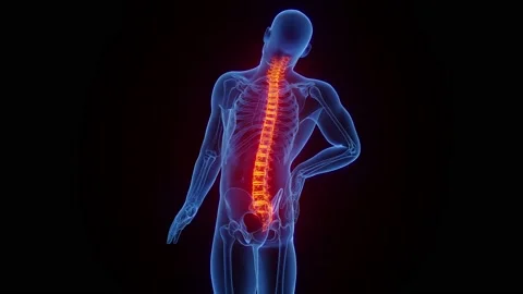 Back Pain Animation Stock Footage ~ Royalty Free Stock Videos | Pond5