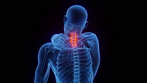 Pain 3D Stock Video Footage | Royalty Free Pain 3D Videos | Pond5