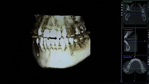 Image A Computer Stock Videos – Royalty-Free HD & 4K Videos