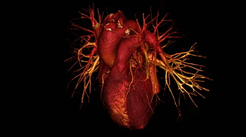 3D reconstruction of a CT scan of a beat... | Stock Video | Pond5
