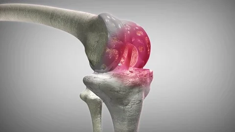 Arthritis 3D Stock Video Footage | Royalty Free Arthritis 3D Videos | Pond5