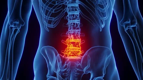 Animated Pictures Of The Spine Injuries
