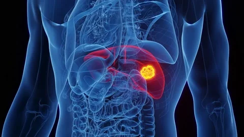 3d rendered medical animation of a liver... | Stock Video | Pond5