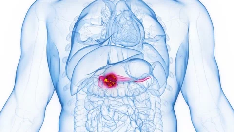 3D rendered Medical Animation of pancrea... | Stock Video | Pond5