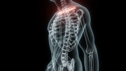 3D Rendering of a Medical Animation of t... | Stock Video | Pond5