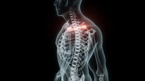 3D Rendering of a Medical Animation of t... | Stock Video | Pond5