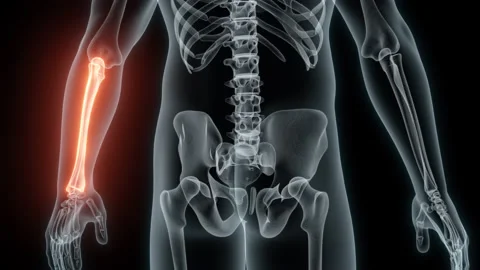 3D rendering of a medical animation of a... | Stock Video | Pond5