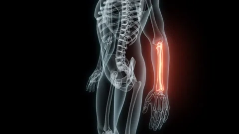 3D rendering of a medical animation of a... | Stock Video | Pond5