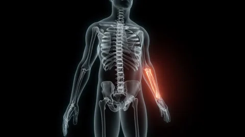 3D rendering of a medical animation of a... | Stock Video | Pond5