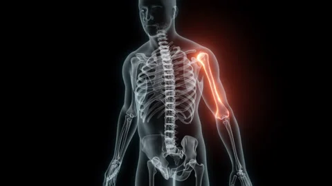 3D rendering of a medical animation of a... | Stock Video | Pond5