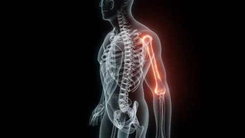 3D rendering of a medical animation of a... | Stock Video | Pond5