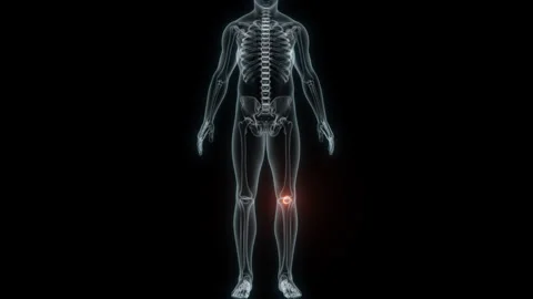 3D Rendering of a Medical Animation of t... | Stock Video | Pond5