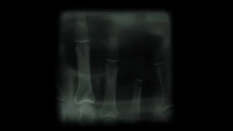 Animated Background 1080X1920 Stock Video Footage | Royalty Free Animated Background 1080X1920 ...