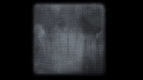4k abstract animated x-ray background | Stock Video | Pond5