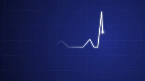 Ekg Monitor Animated Heart Stock Videos – Royalty-Free HD & 4K Videos