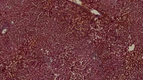 4K animation of human liver cells under ... | Stock Video | Pond5