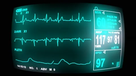 4k ECG monitor screen, hd, 1080p high de... | Stock Video | Pond5